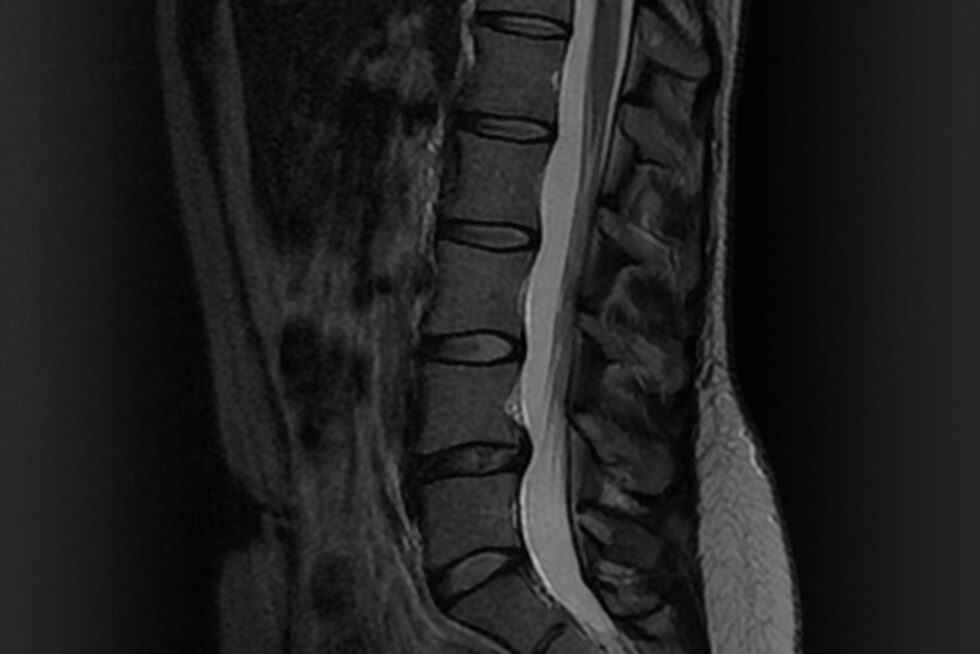 Vedr. MR skanning | Amager Røntgen